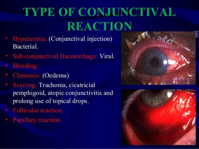 Conjunctiva anatomy and physiology