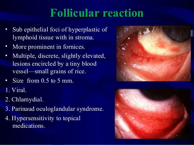 Conjunctiva anatomy and physiology