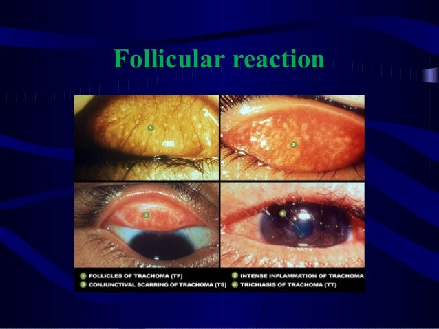 Conjunctiva anatomy and physiology