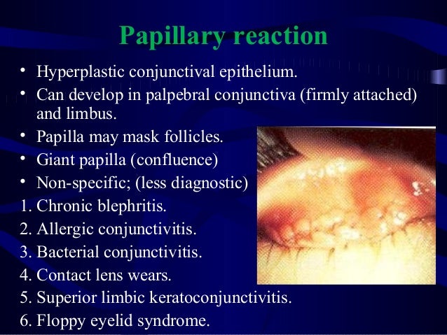 Conjunctiva anatomy and physiology