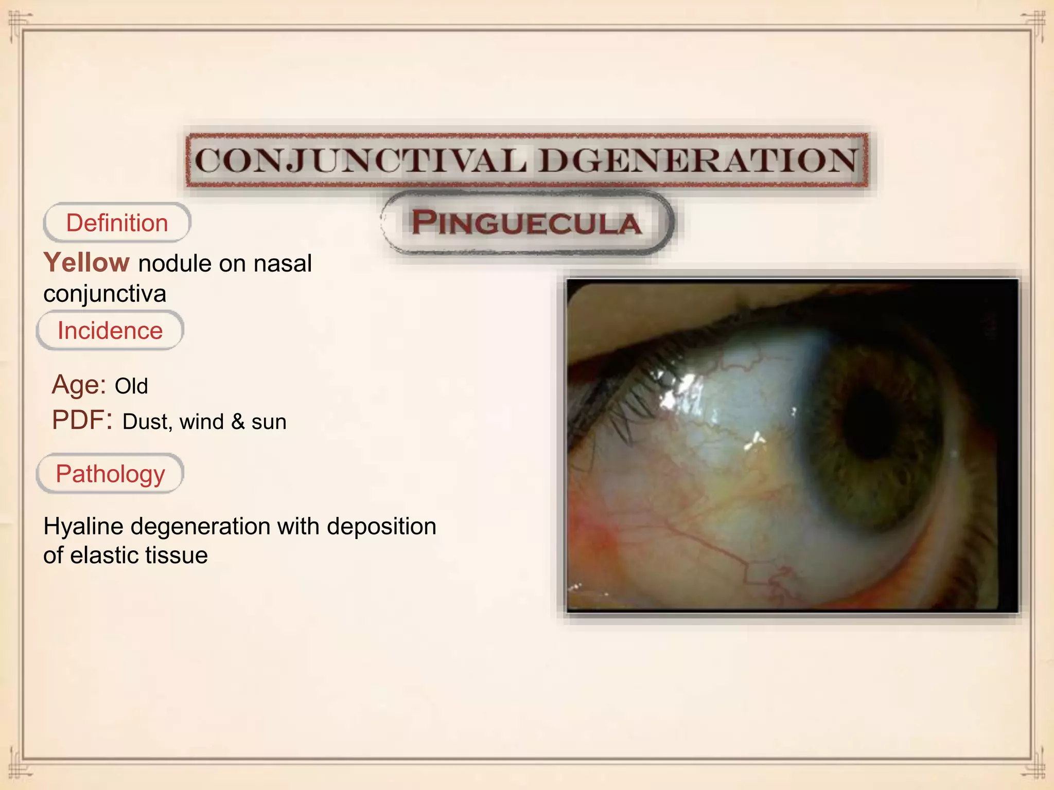 Conjunctiva integrated.pptx