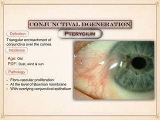 Conjunctiva integrated.pptx