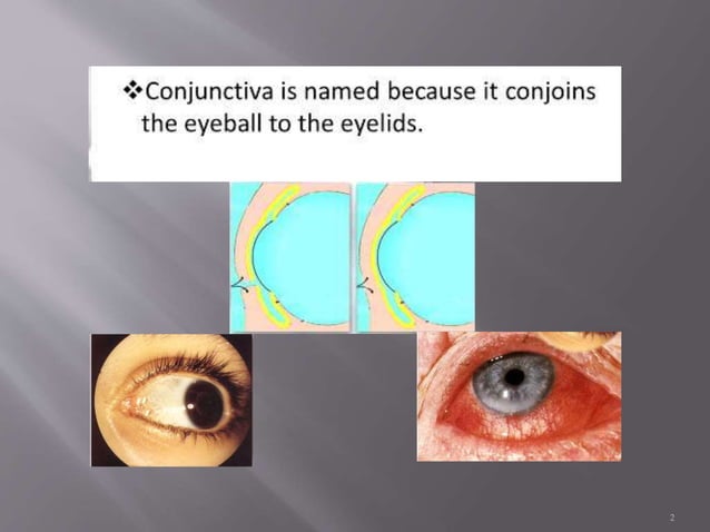 Conjunctiva.pptx