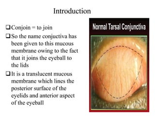 Conjunctival anatomy | PPT
