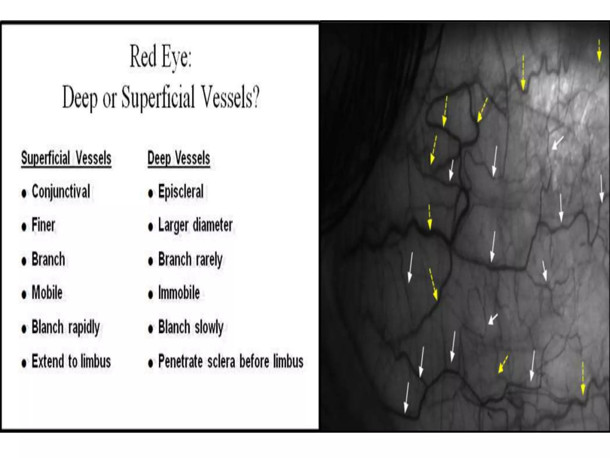 Conjunctival anatomy & and blood supply | PPTX
