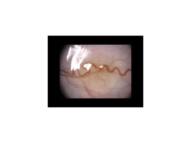 Conjunctival anatomy & and blood supply | PPTX | Eye and Vision ...