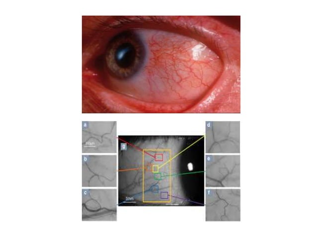 Conjunctival anatomy & and blood supply | PPTX | Eye and Vision ...