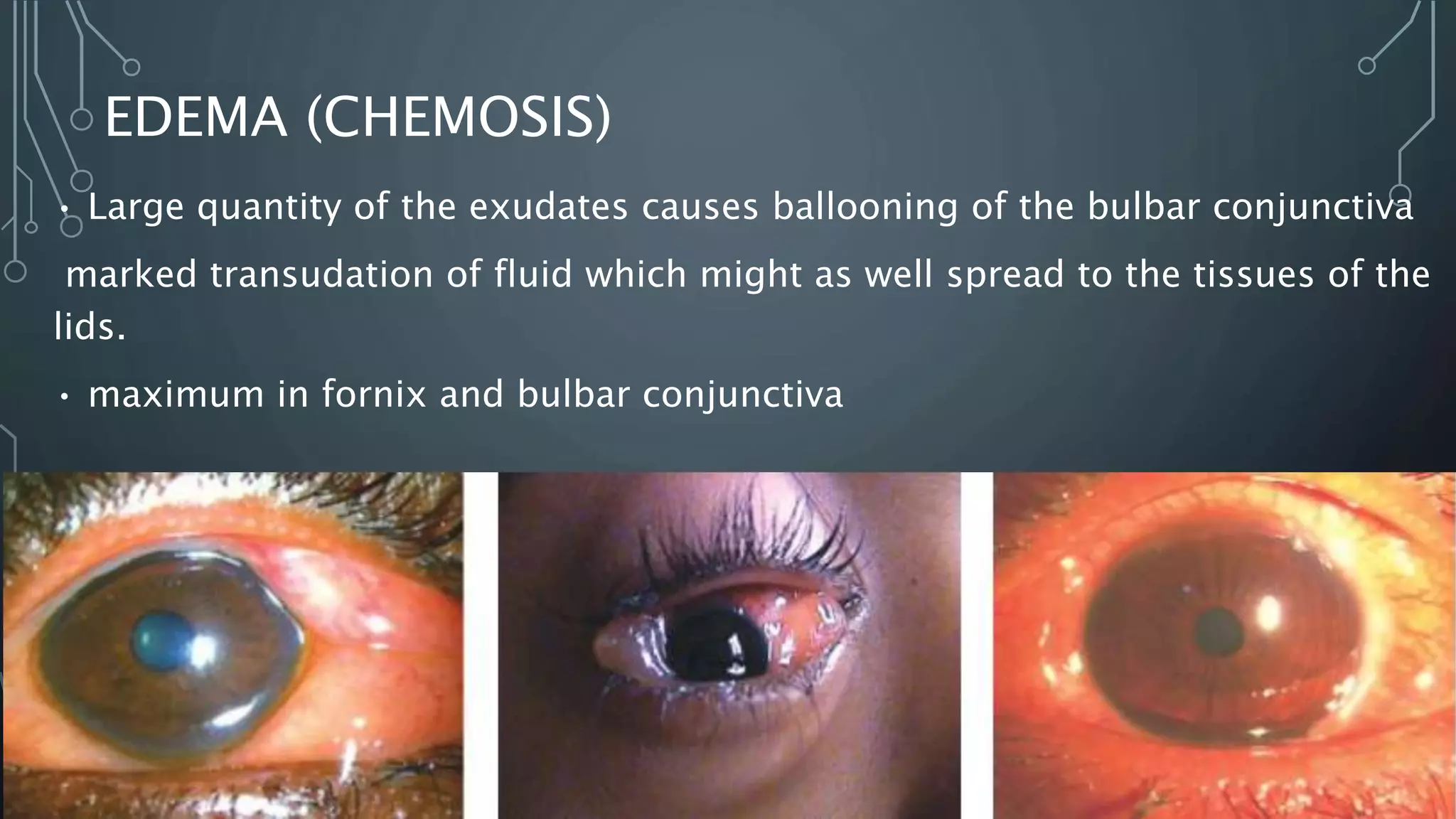 common Conjunctival conditions | PPTX
