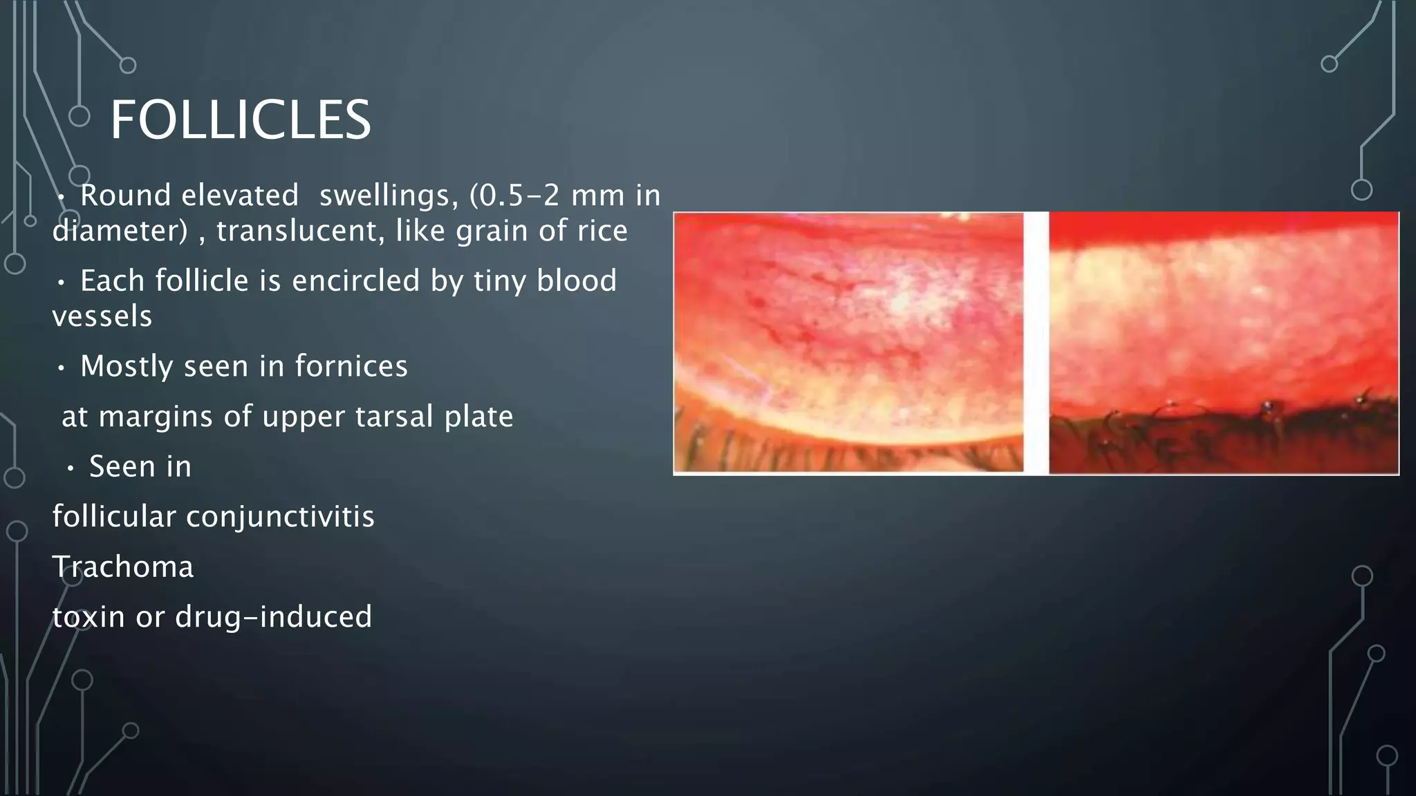 common Conjunctival conditions | PPTX