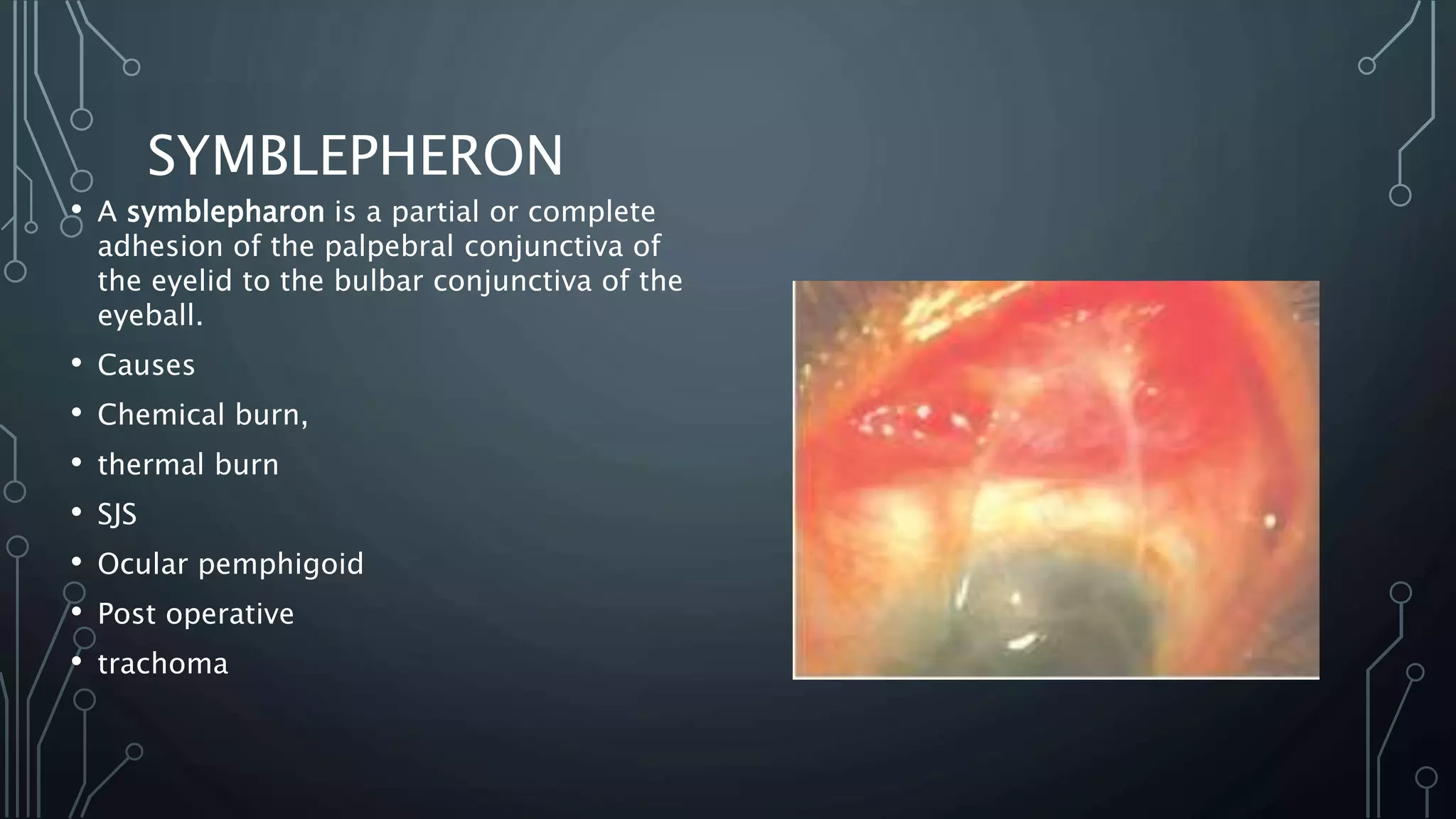 common Conjunctival conditions | PPTX
