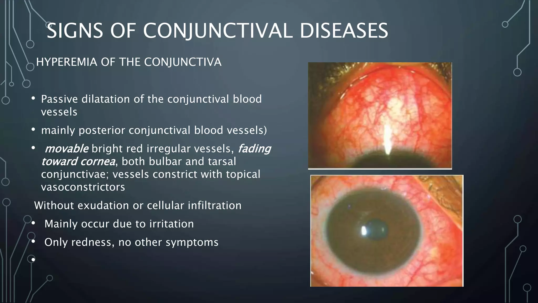 common Conjunctival conditions | PPTX