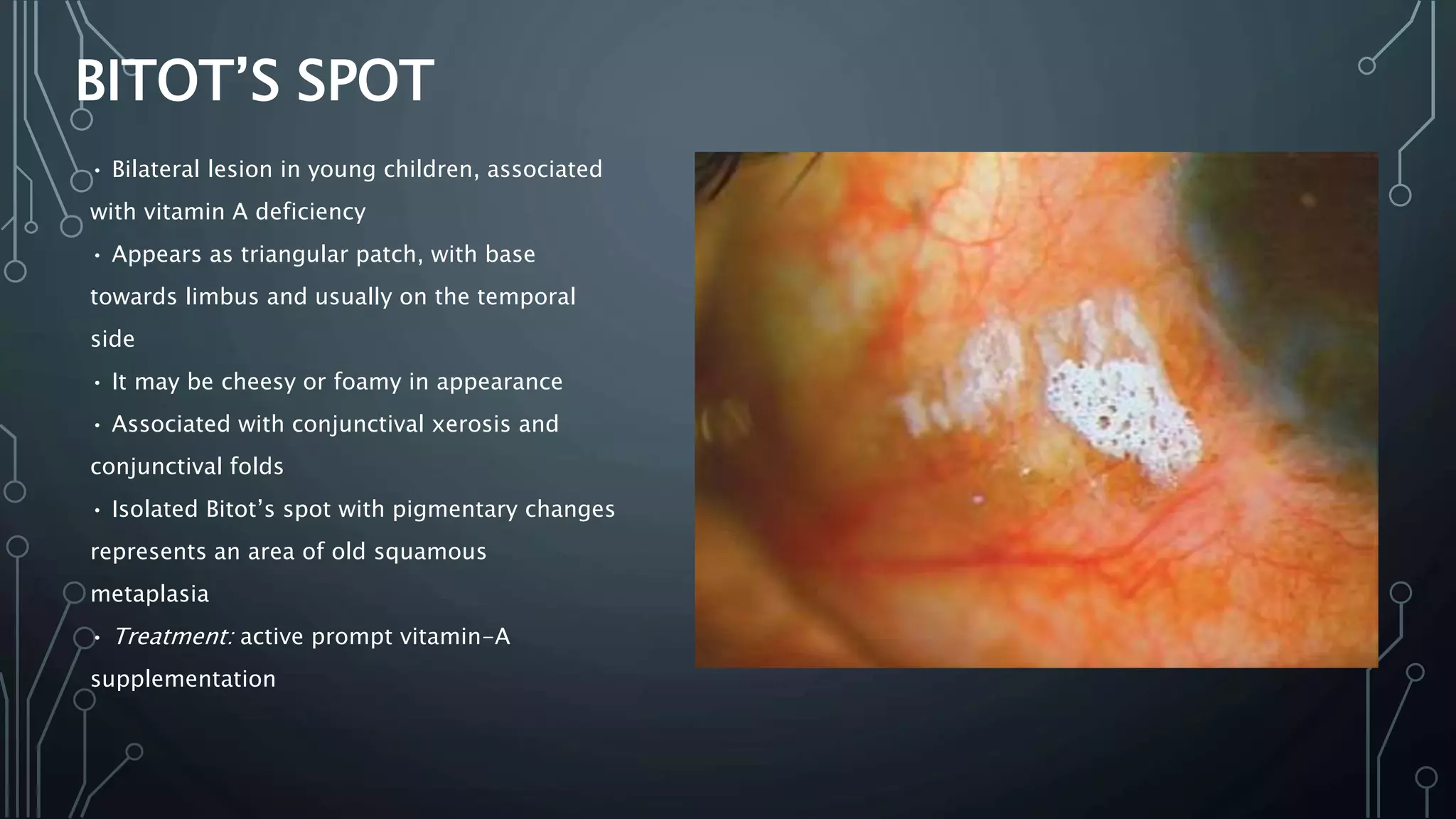 common Conjunctival conditions | PPTX