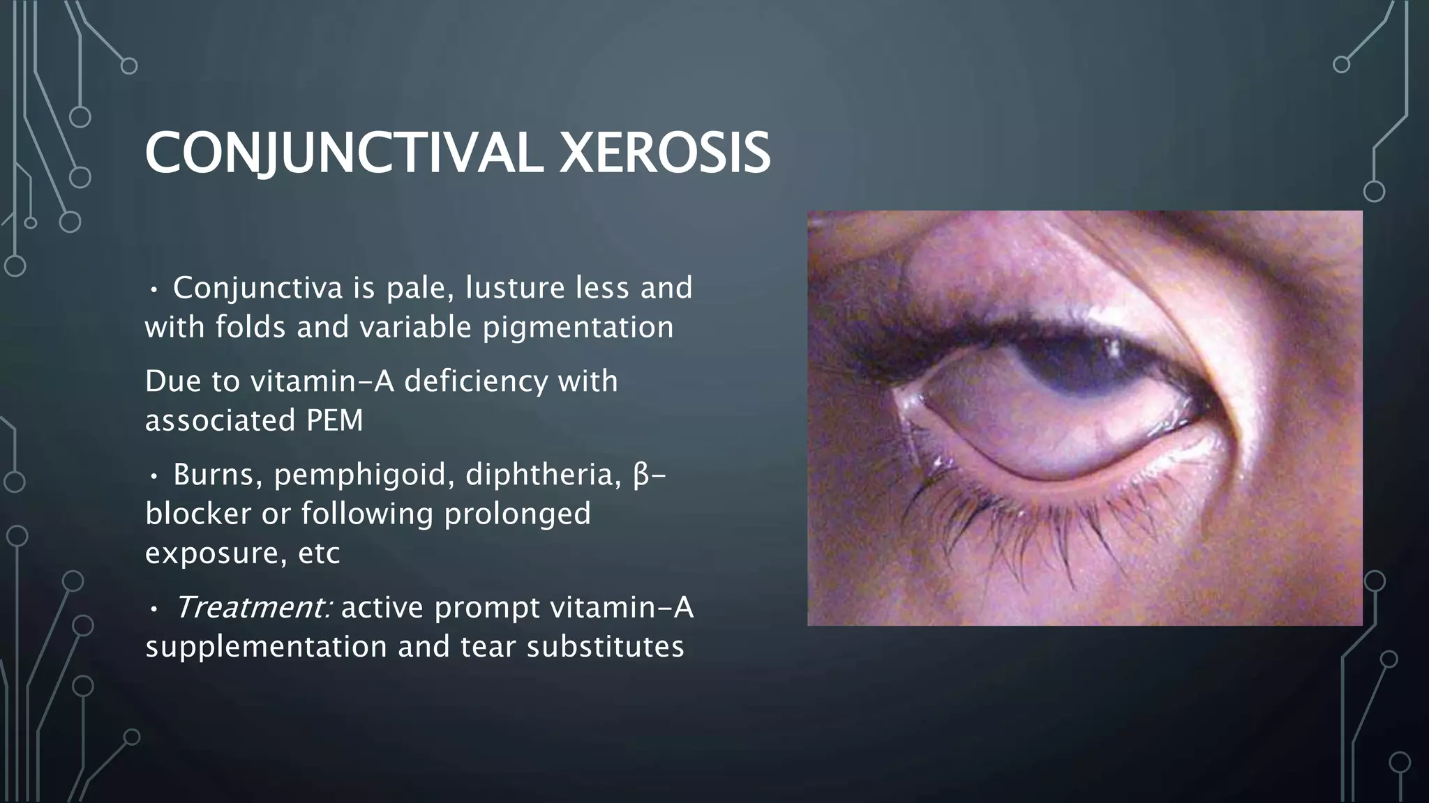 common Conjunctival conditions | PPTX