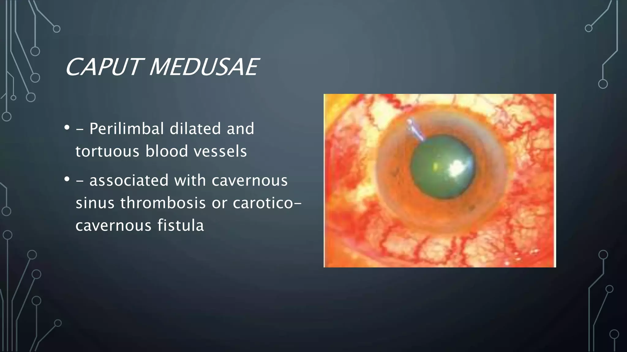 common Conjunctival conditions | PPTX