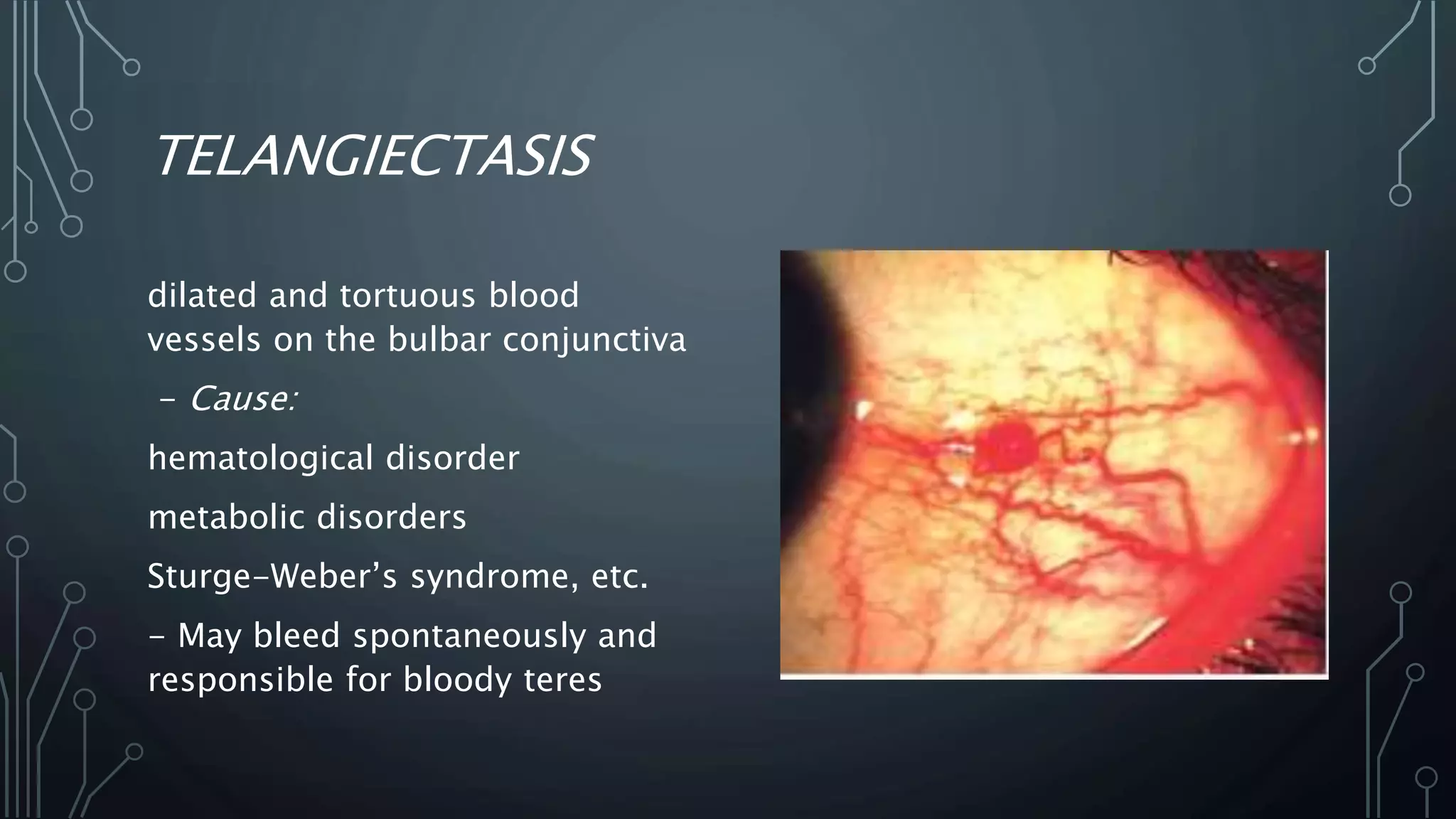 common Conjunctival conditions | PPTX