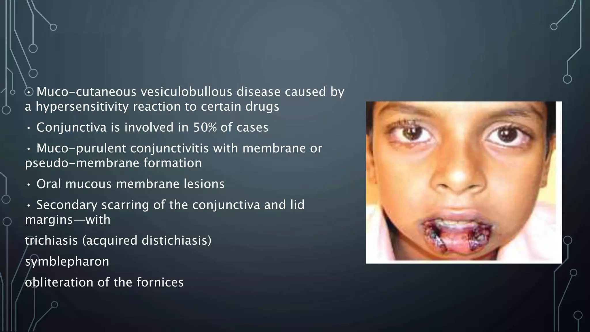 common Conjunctival conditions | PPTX