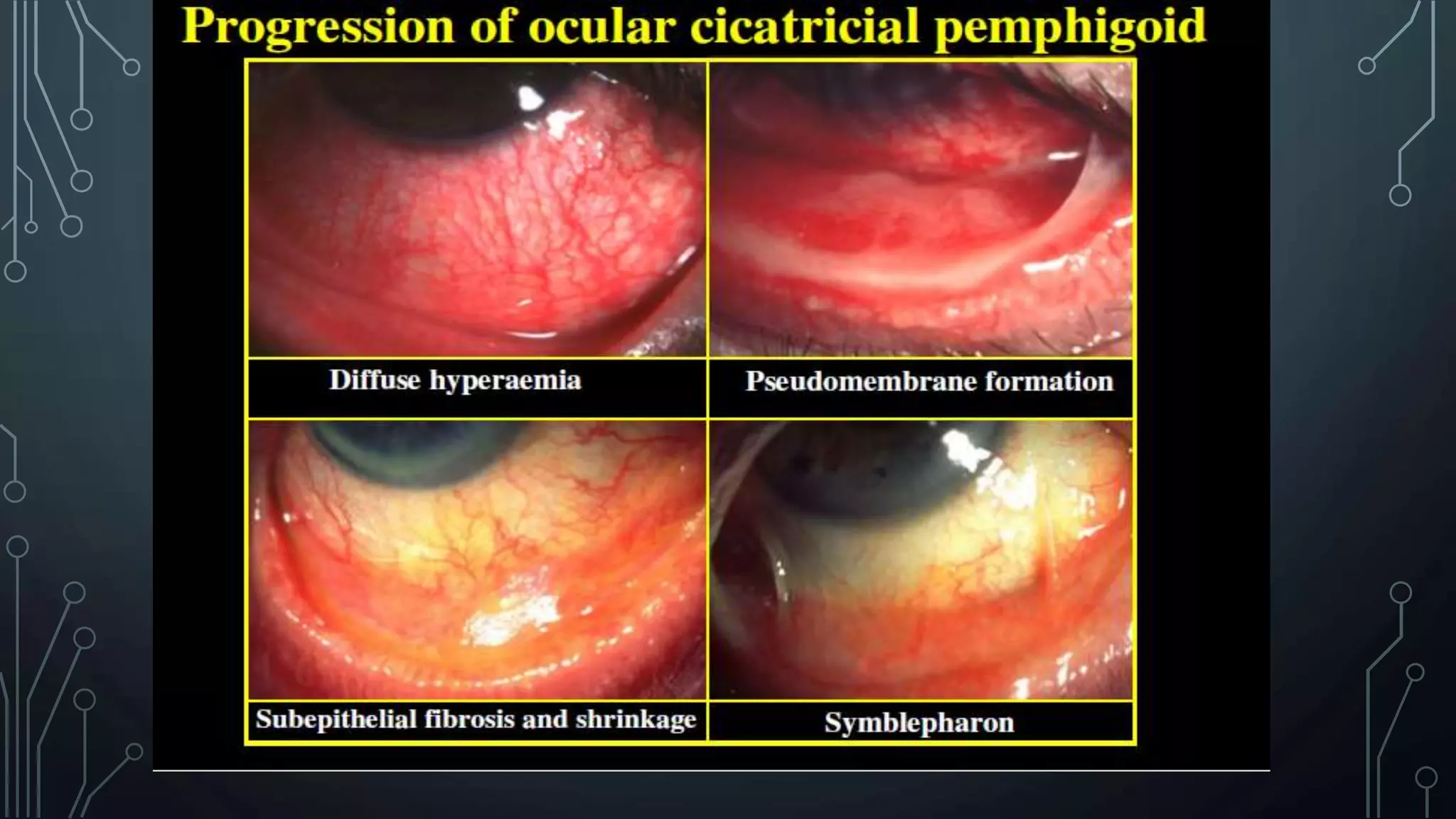 common Conjunctival conditions | PPTX