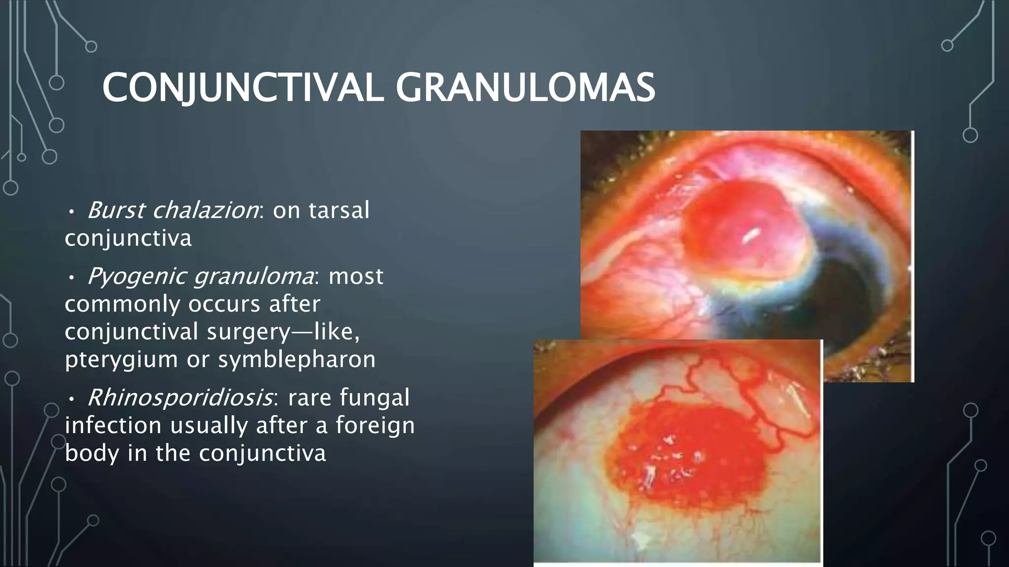 common Conjunctival conditions | PPTX