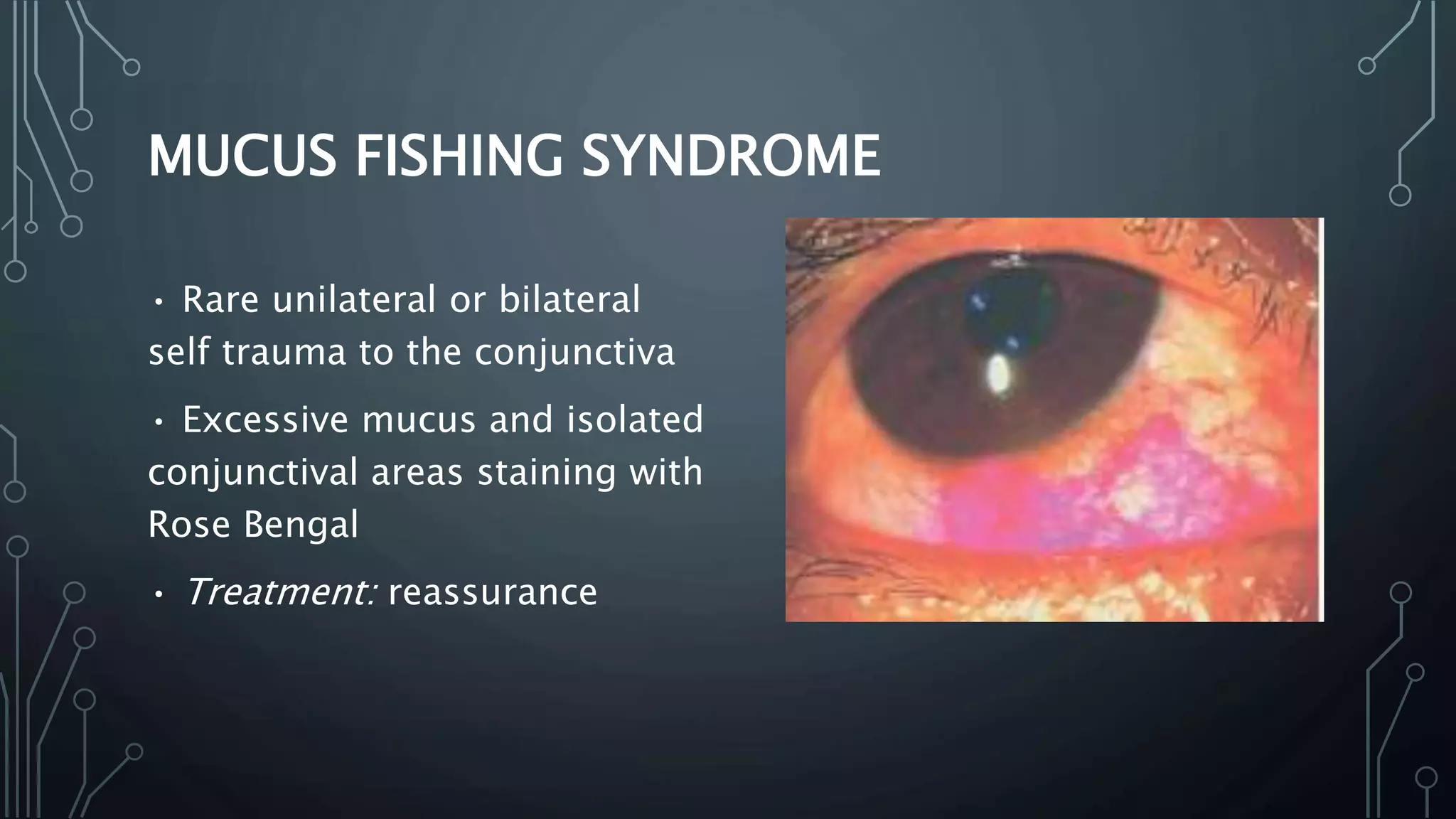 common Conjunctival conditions | PPTX