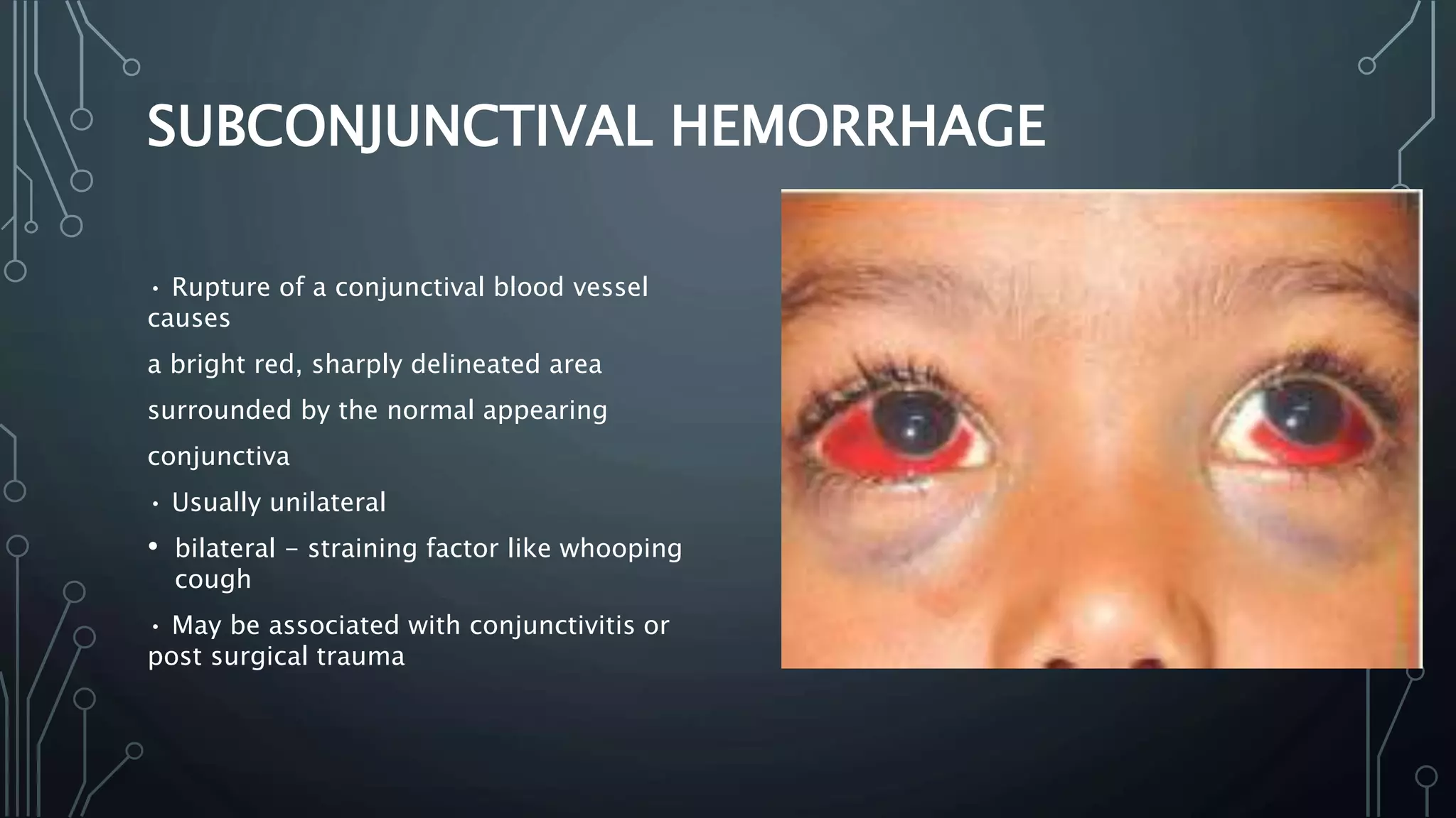 common Conjunctival conditions | PPTX