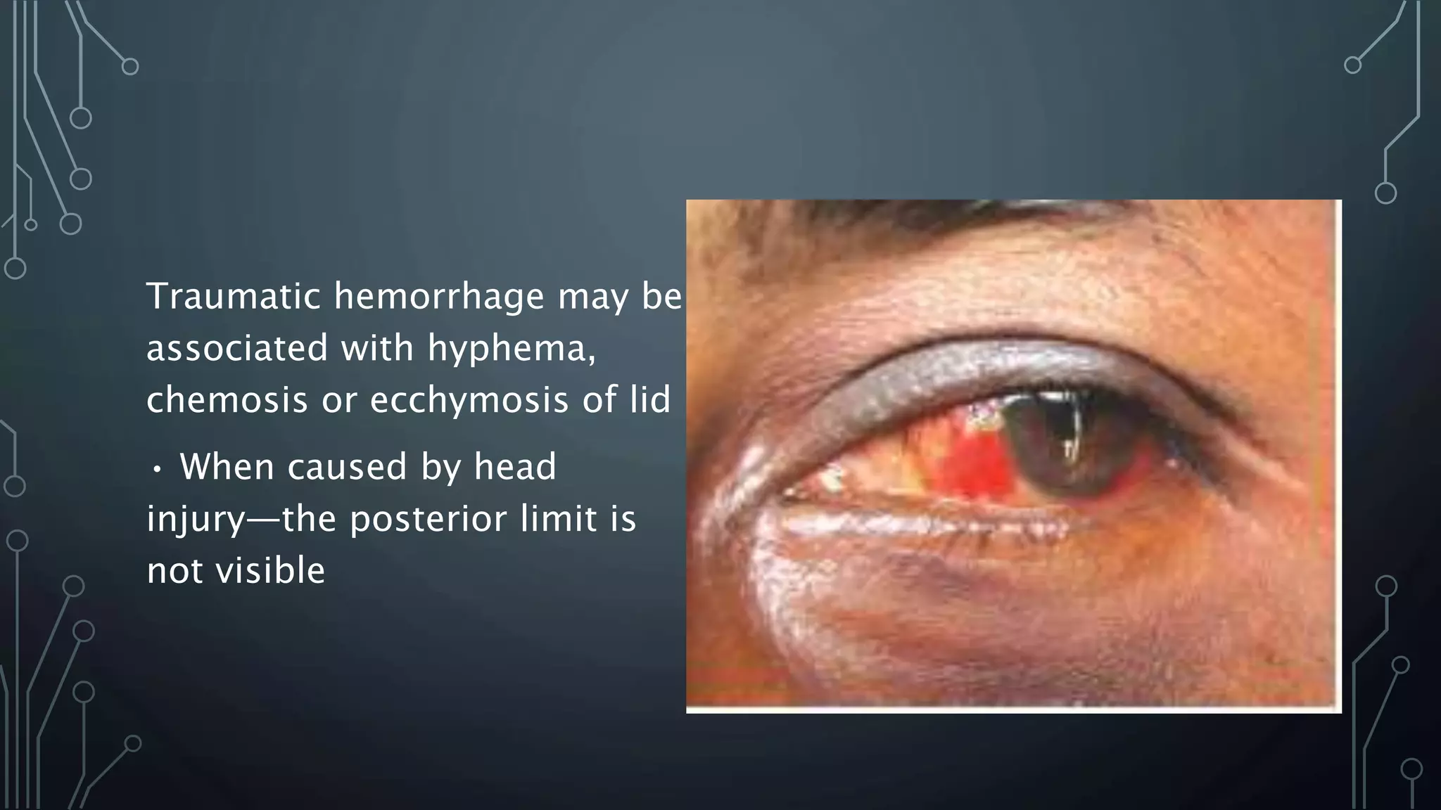 common Conjunctival conditions | PPTX