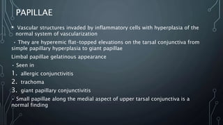 common Conjunctival conditions | PPTX