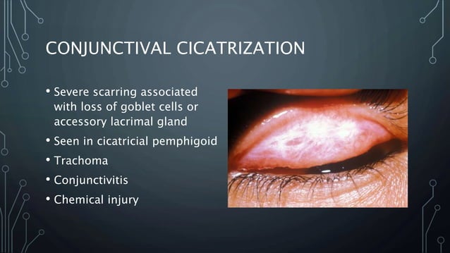 common Conjunctival conditions | PPTX | Blood Disorders | Diseases and ...