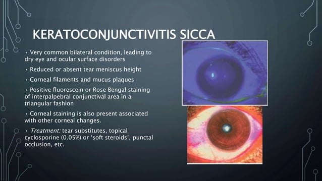 common Conjunctival conditions | PPTX | Blood Disorders | Diseases and ...