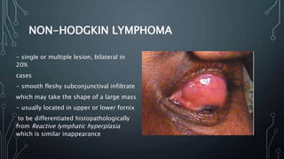 common Conjunctival conditions | PPTX