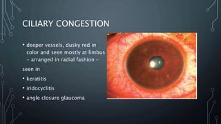 common Conjunctival conditions | PPTX