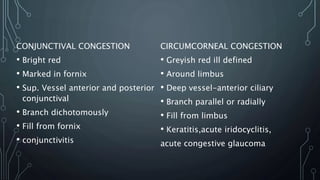common Conjunctival conditions | PPTX