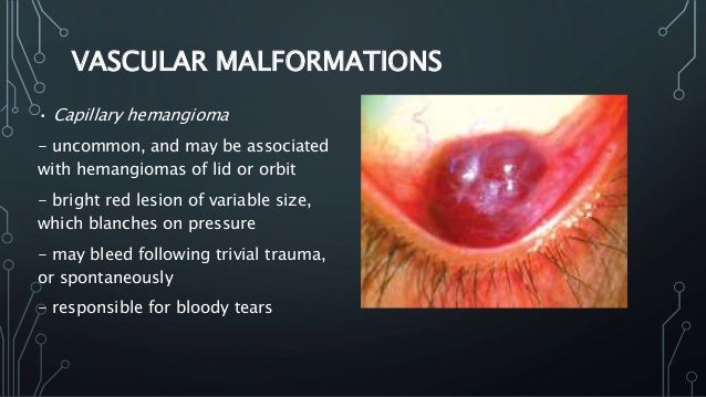 common Conjunctival conditions