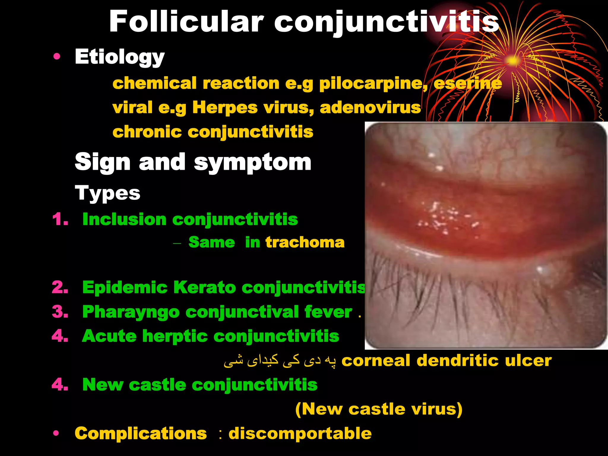 Conjunctival diseases by dr abdul basir safi | PPT | Ear, Nose and Throat Conditions | Diseases ...