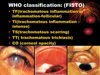 Conjunctival diseases by dr abdul basir safi | PPT | Ear, Nose and ...