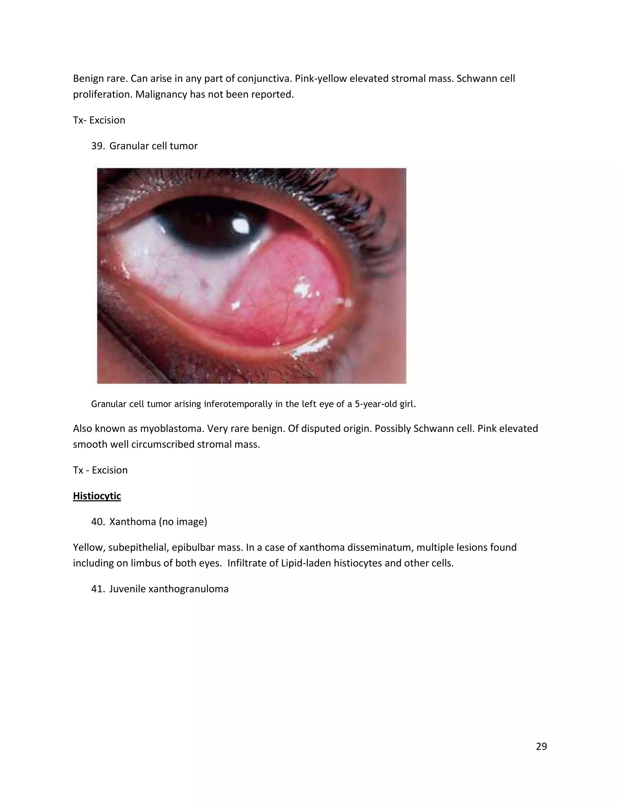 Conjunctival tumors | DOCX