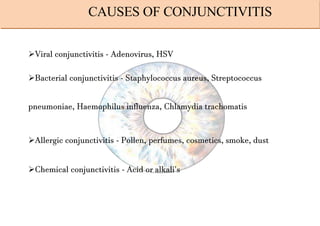 Conjunctivatis presentation.AJ.pptx