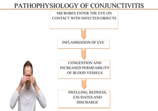 Conjunctivatis presentation.AJ.pptx