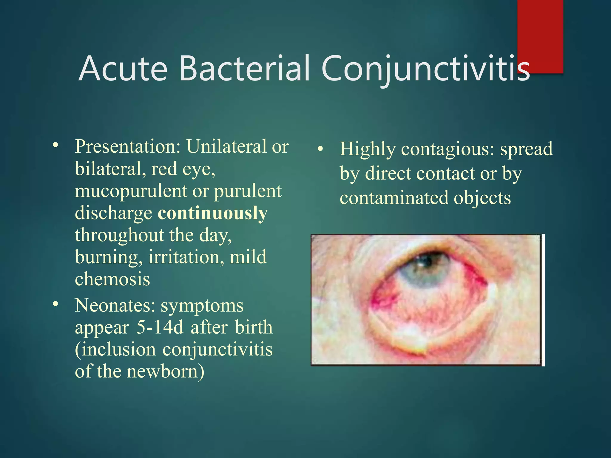 Conjunctivitis 120201025034-phpapp02-converted | PPTX | Infectious ...