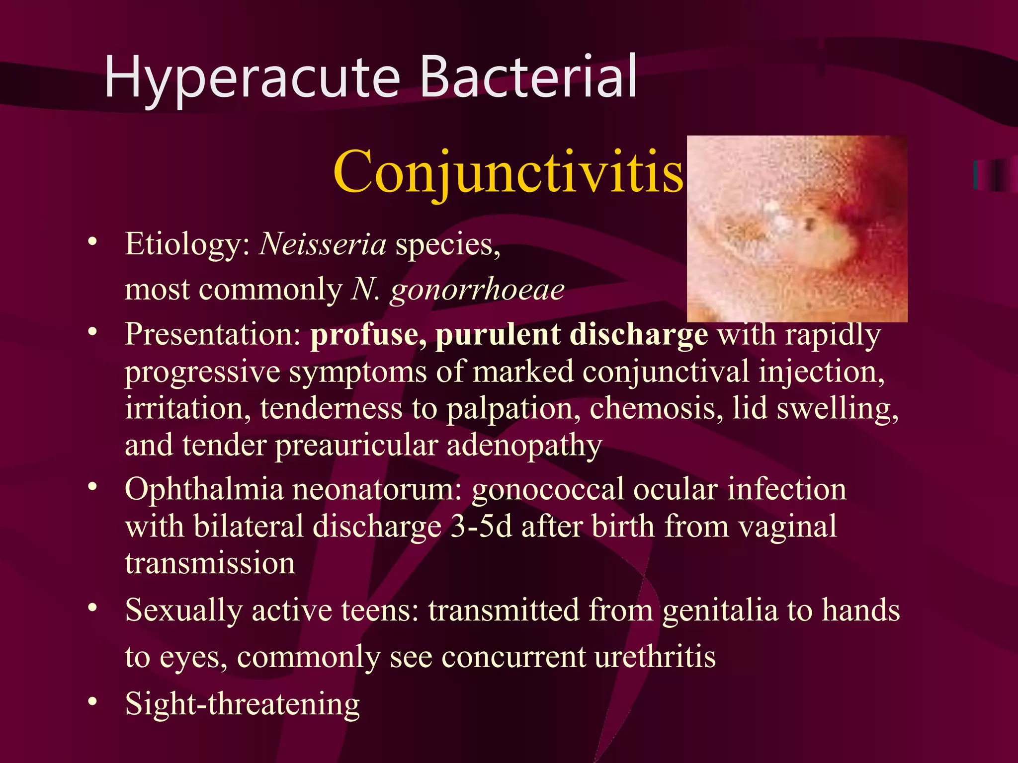 Conjunctivitis 120201025034-phpapp02-converted | PPT