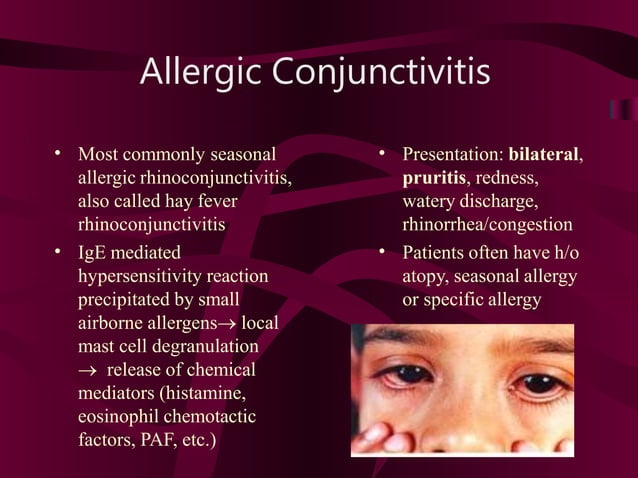 Conjunctivitis 120201025034-phpapp02-converted | PPT