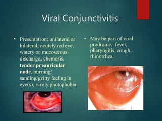 Conjunctivitis 120201025034-phpapp02-converted | PPTX