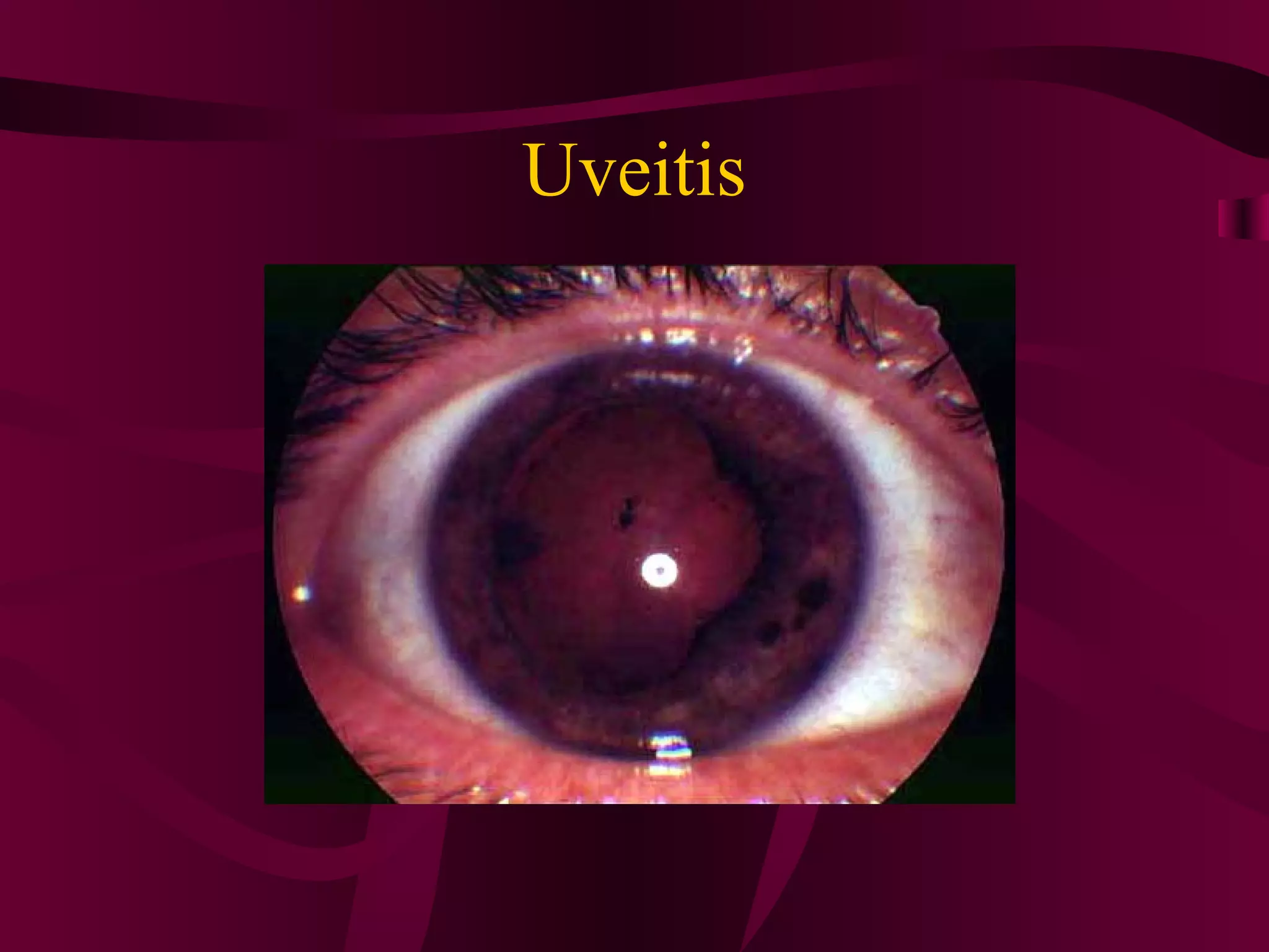 Conjunctivitis | PPT
