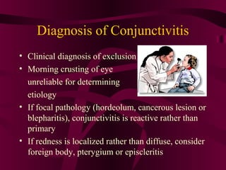 Conjunctivitis | PPT