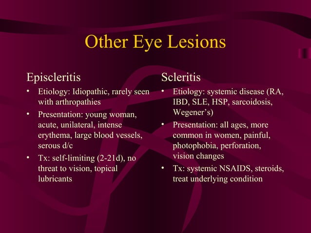 Conjunctivitis | PPT