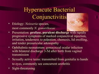 Conjunctivitis | PPT