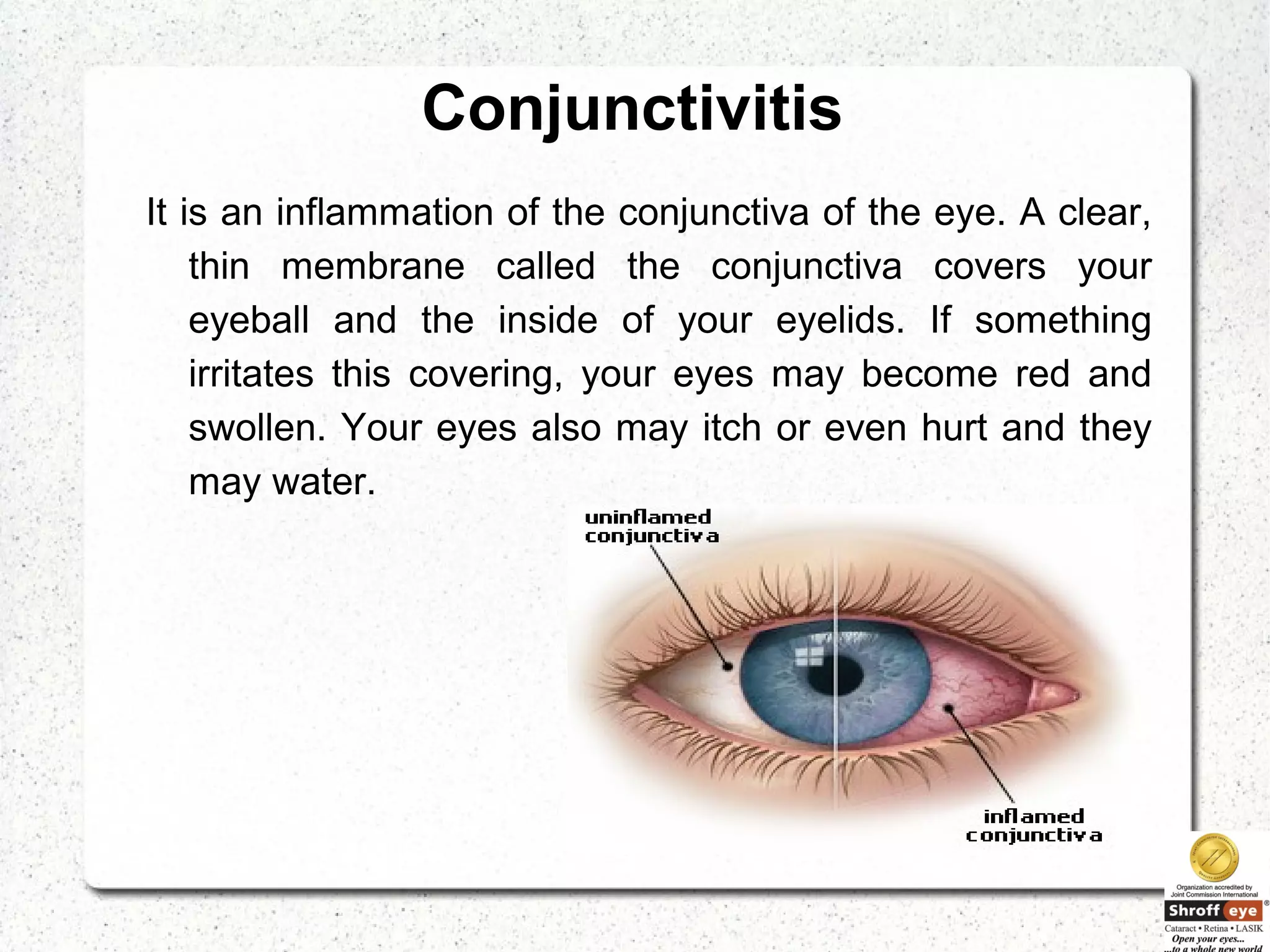 What are the Symtoms and precautions of Conjunctivitis | PPT