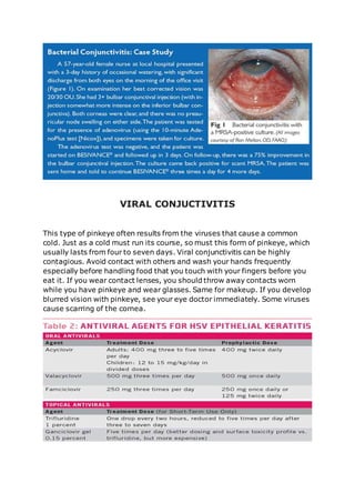 Conjunctivitis by Dr.prudhvi | DOCX | Infectious Diseases | Diseases and Conditions