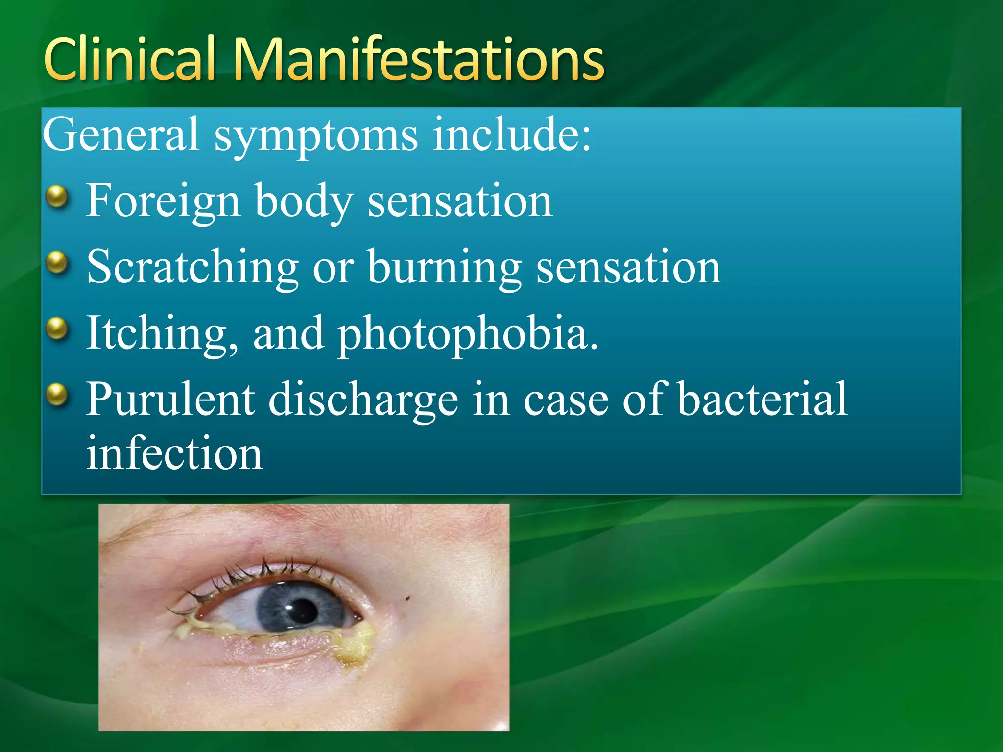 Conjunctivitis | PPTX