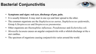 Conjunctivitis | PDF