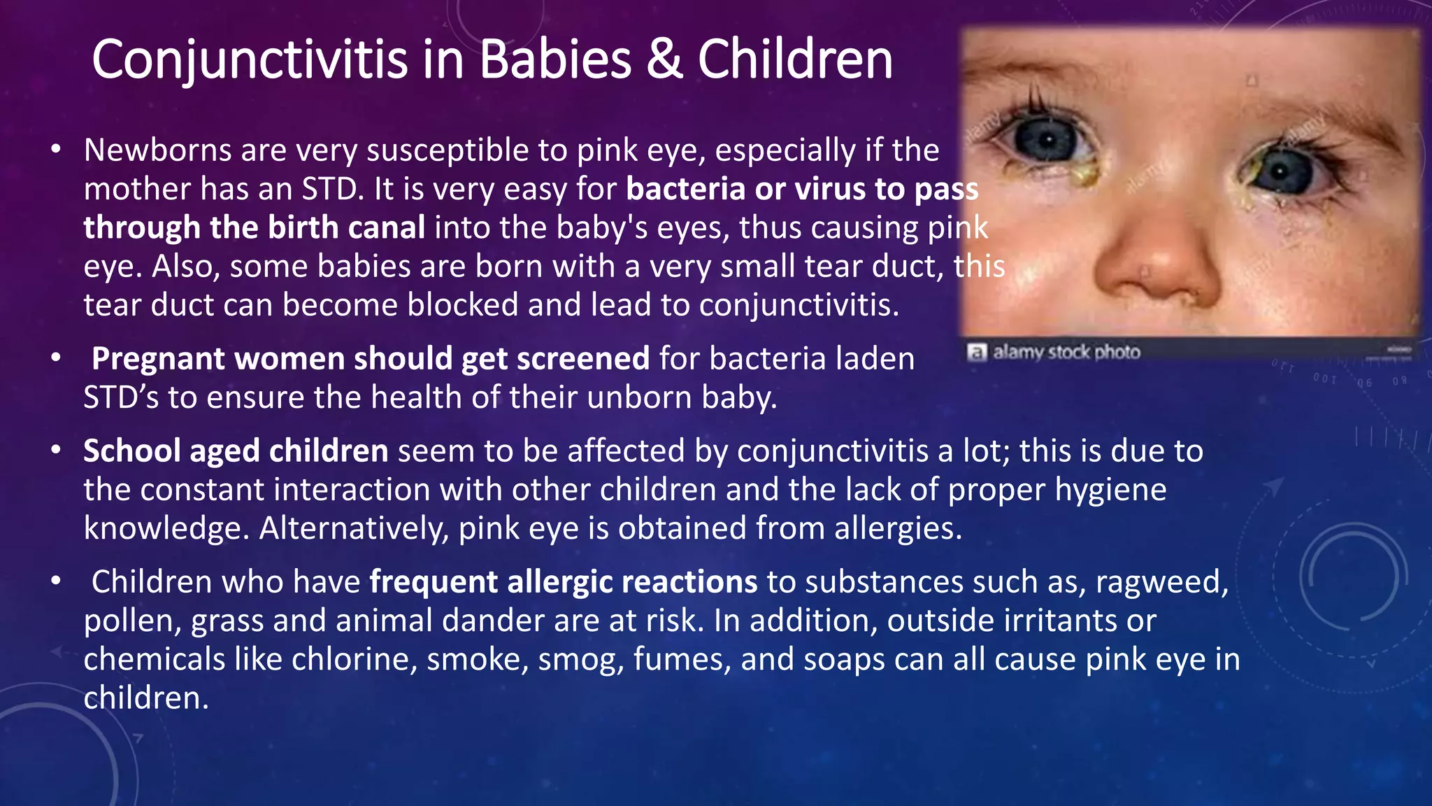 Conjunctivitis | PPTX